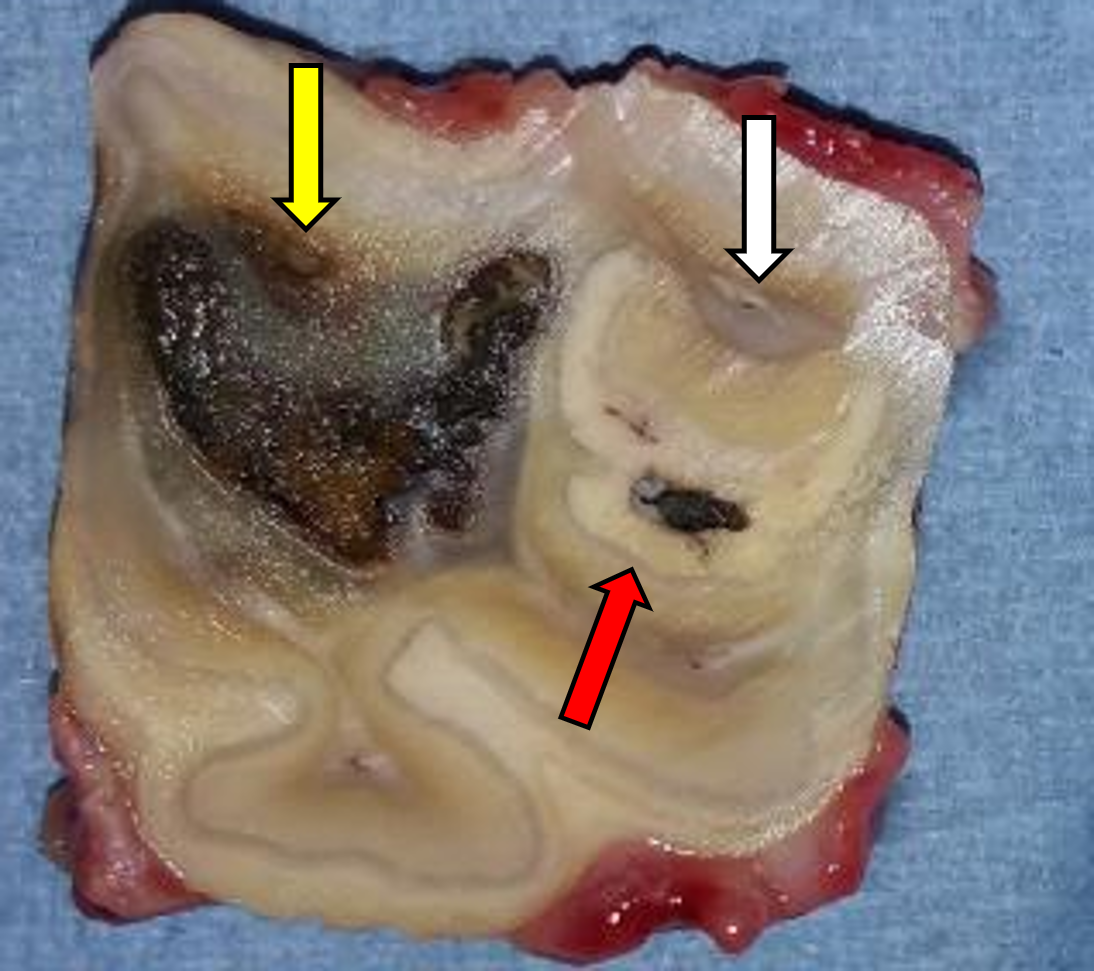 Update on the aetiopathogenesis of equine cheek teeth infundibular ...
